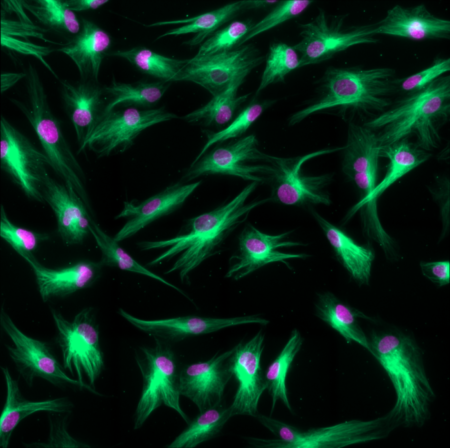 SiR-tubulin kit - Live cell microtubule probe - spirochrome