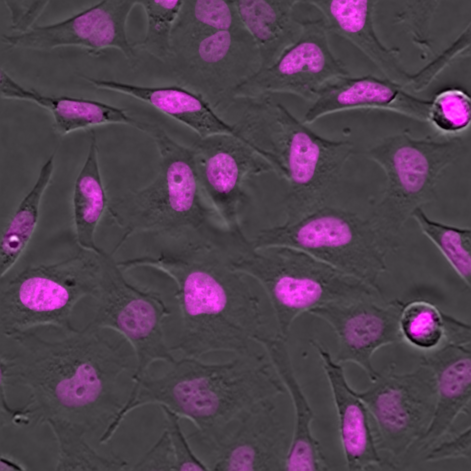 SPY555-DNA - Live cell DNA stain - spirochrome