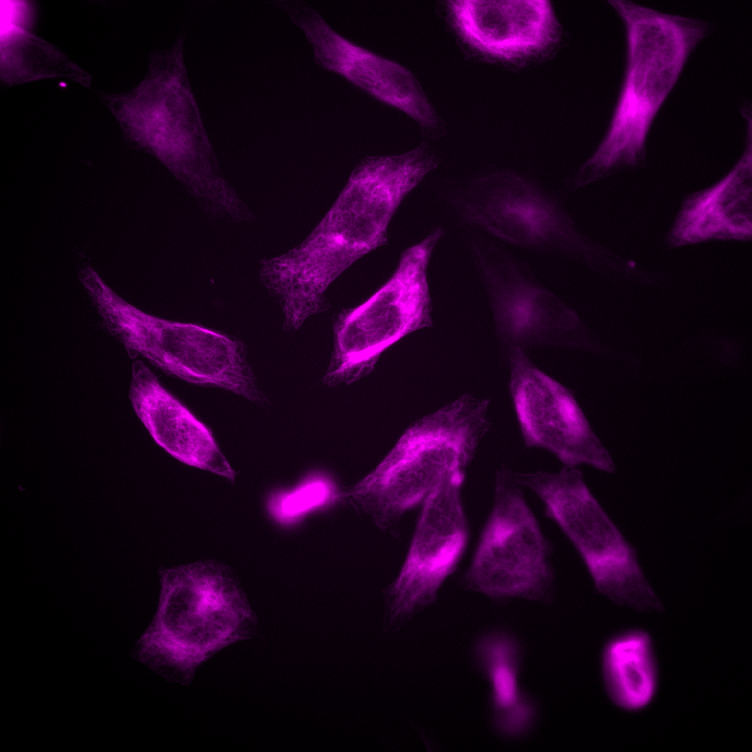 SPY555-tubulin - Live cell microtubule probe - spirochrome