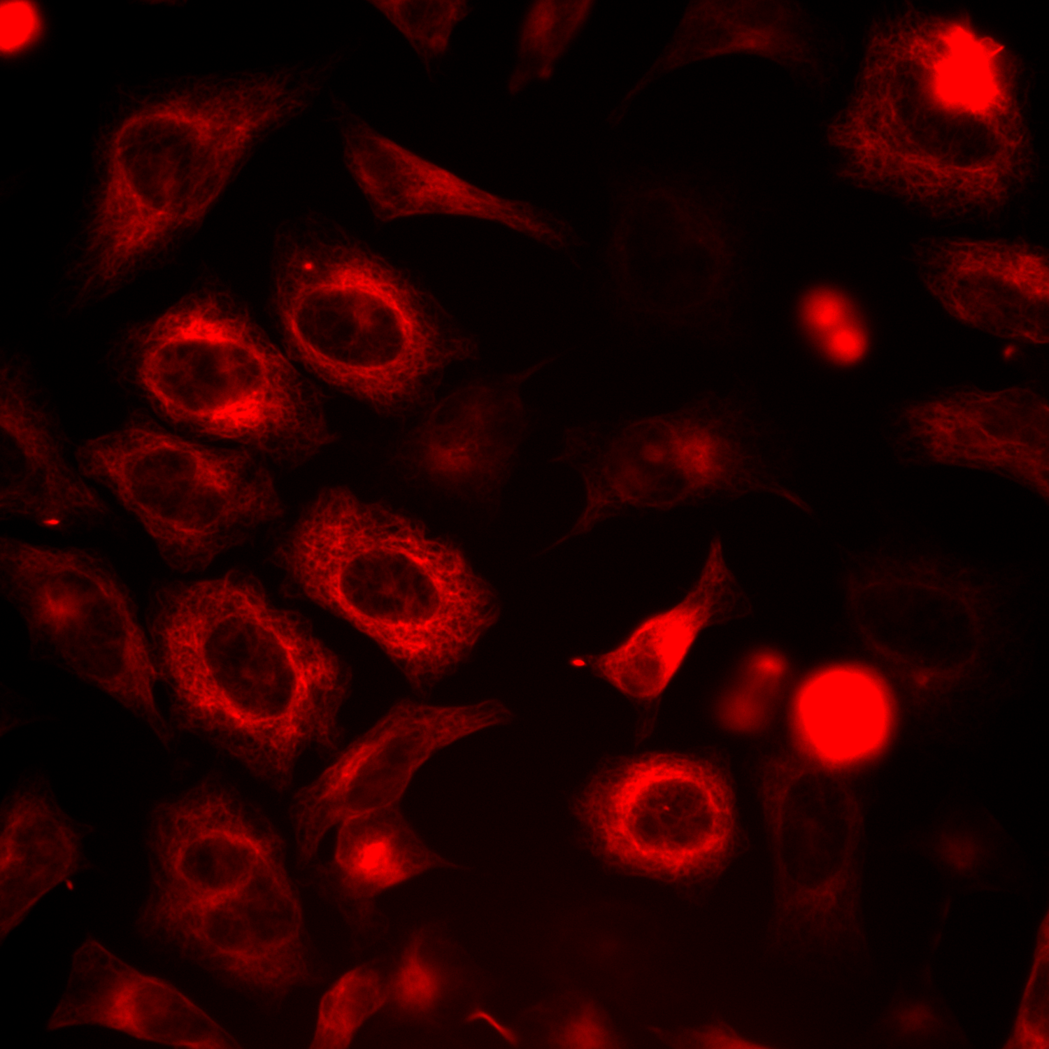 SPY650-tubulin - Live cell microtubule probe - spirochrome