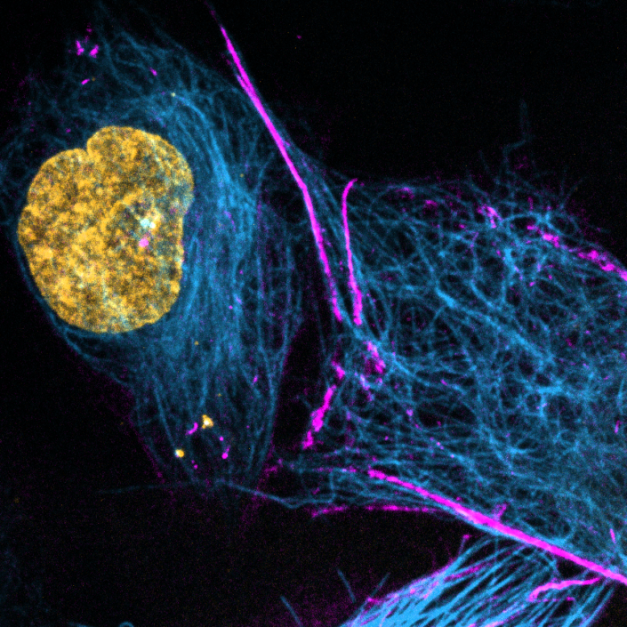 SPY555-actin - Live cell actin probe - spirochrome