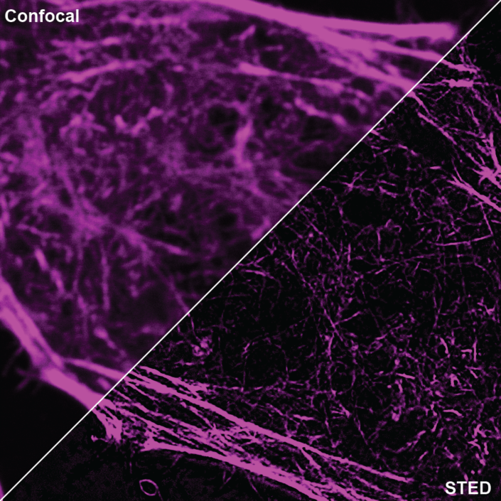 SPY555-actin - Live cell actin probe - spirochrome