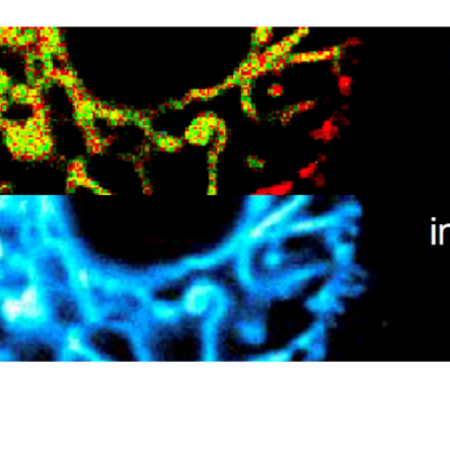 ER Flipper-TR® - ER specific membrane tension probe - spirochrome
