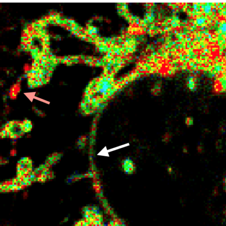 ER Flipper-TR® - ER specific membrane tension probe - spirochrome