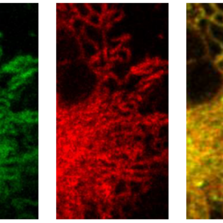 ER Flipper-TR® - ER specific membrane tension probe - spirochrome
