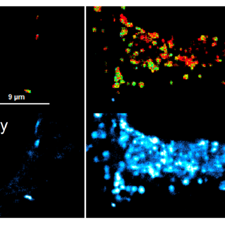 Lyso Flipper-TR® - Lysosome specific membrane tension probe - spirochrome
