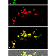 Lyso Flipper-TR® - Lysosome specific membrane tension probe - spirochrome