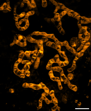 PKmito ORANGE FX - Probe for fixed cells imaging of mitochondria