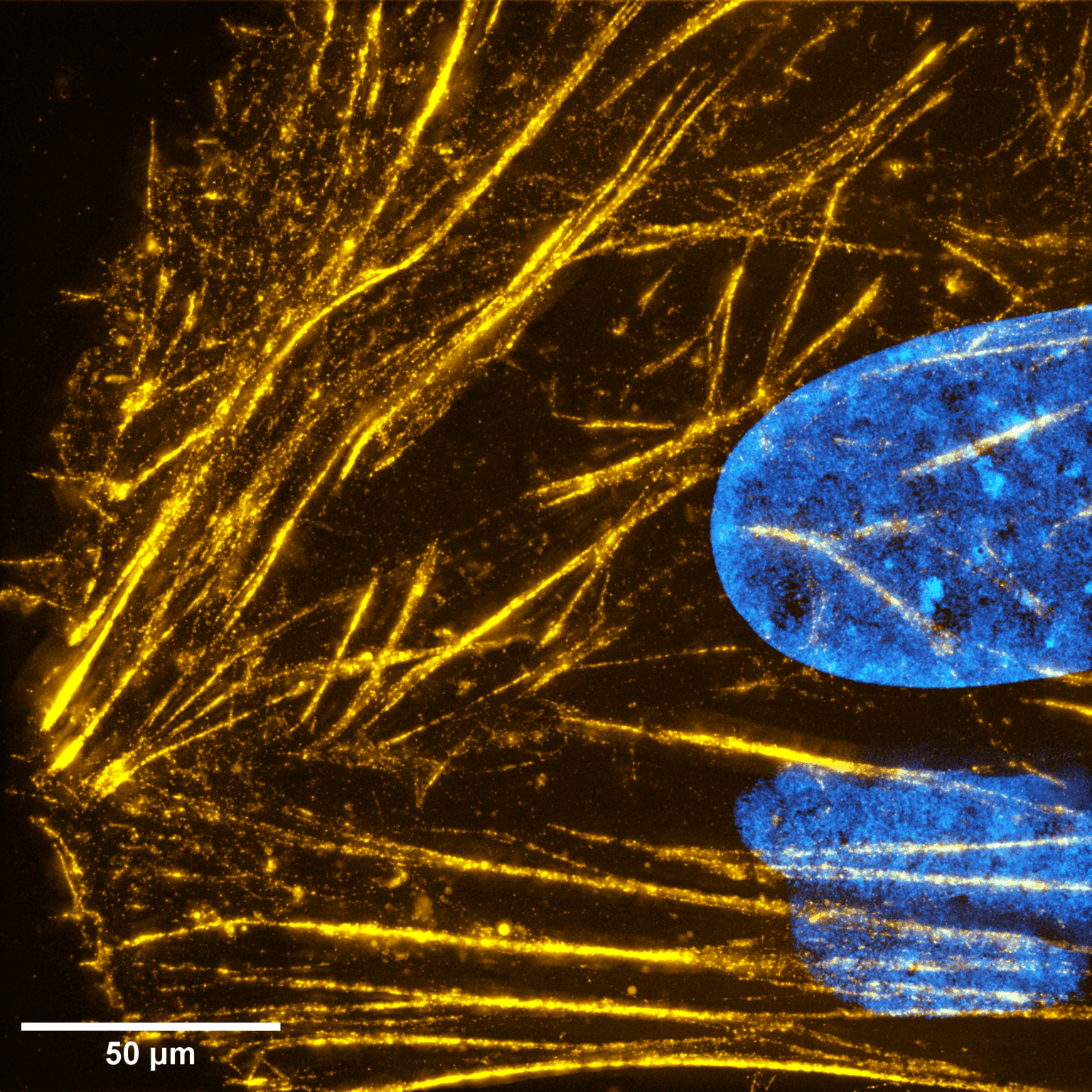 HAK-actin™ - Actin Expansion Microscopy Probe - Spirochrome